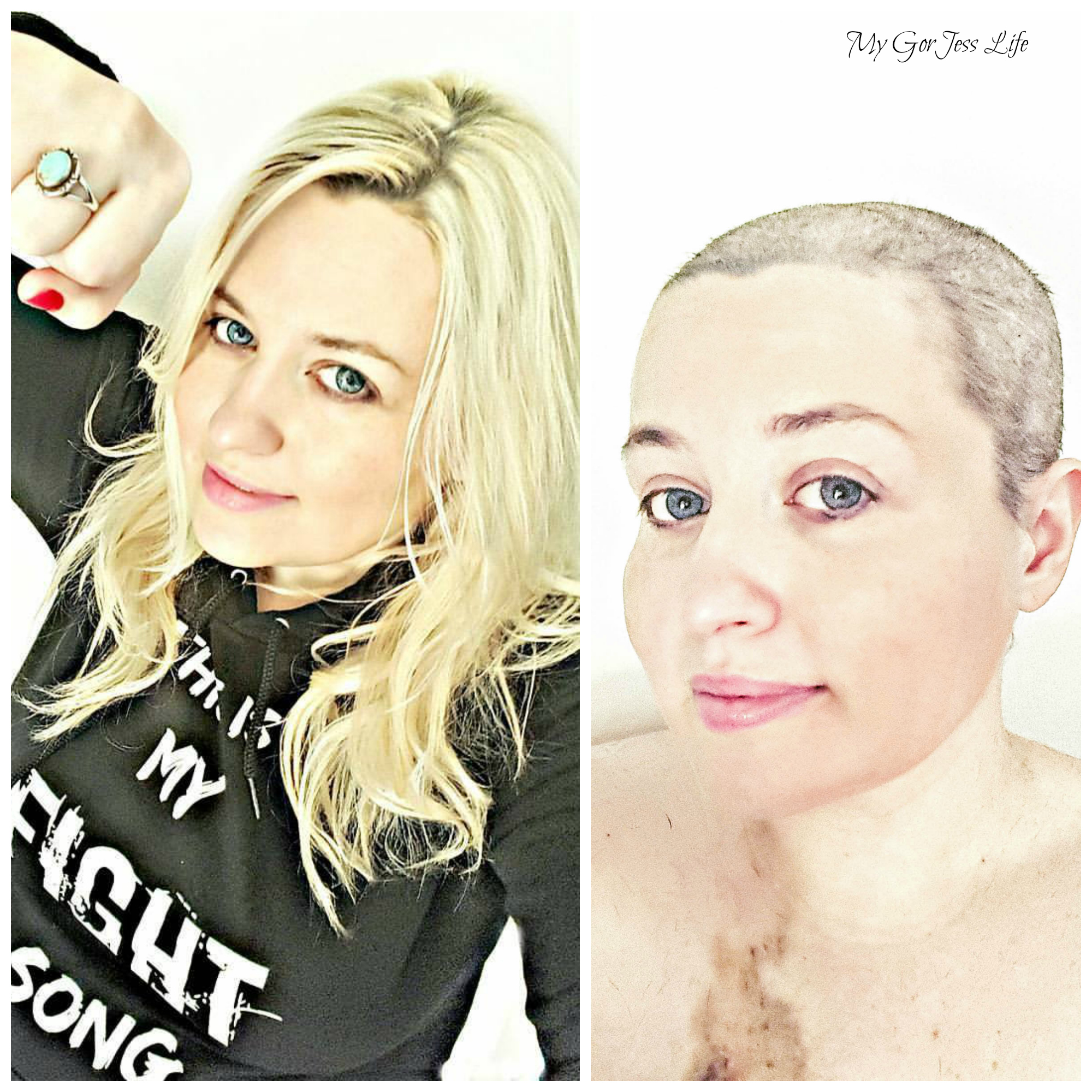 The Bald and the Beautiful – My GorJess Life
